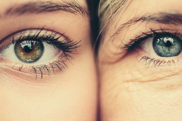 Skin Ageing: Chronoaging And Photoaging