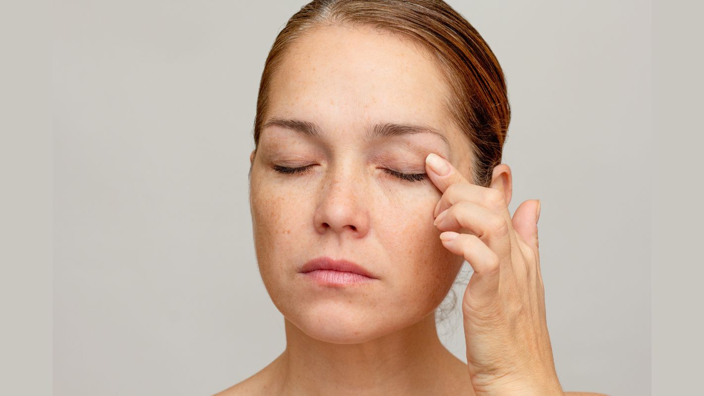 How to Get Rid of Yellow Skin Tone: Causes, Remedies & Skincare